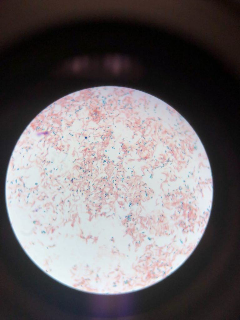 Simple staining techniques for the identification of Bacterial cultures ...